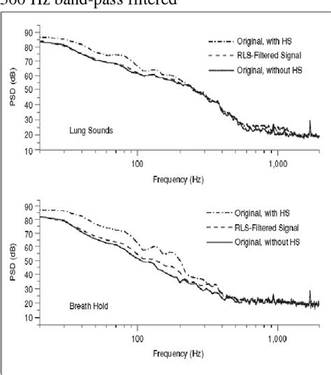 Figure 2 From Survey On Separation Of Heart Sounds From Lung Sounds By Adaptive Filtering