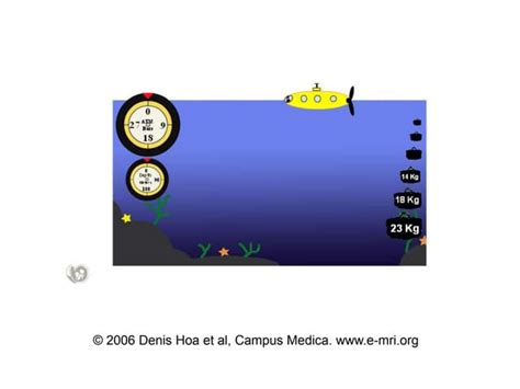 E Mri Spatialencodingslides Ppt