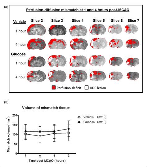 Spatial Distributions Of Perfusion Diffusion Mismatch Tissue Across Six Download Scientific