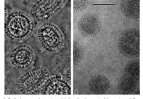 Electron Microscope Real Flu Virus Micropedia T Virus Under Microscope