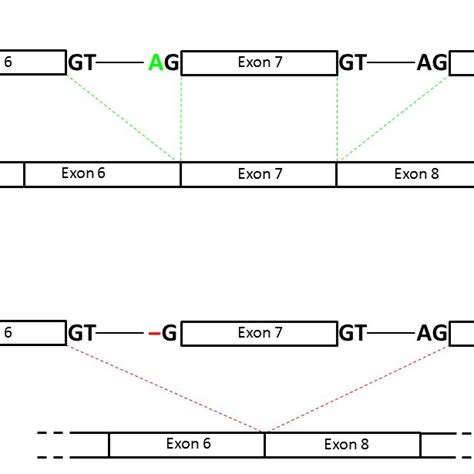 Pdf Novel Splice Site Mutation In The Pros1 Gene In A Polish Patient With Venous