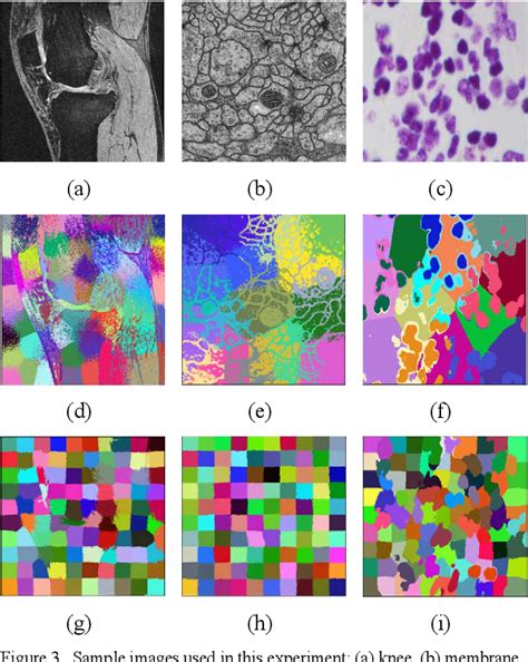 Figure 3 From Image To Graph Transformation Via Superpixel Clustering