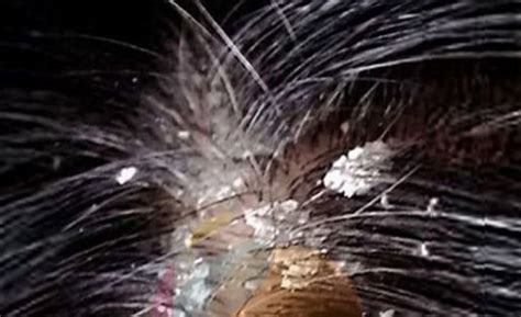 Selenium Shampoo Beauty And Personal Care Hair On Carousell