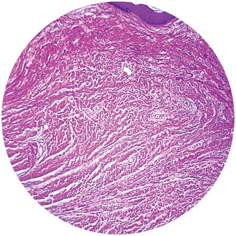 Keratinized Stratified Squamous Epithelium