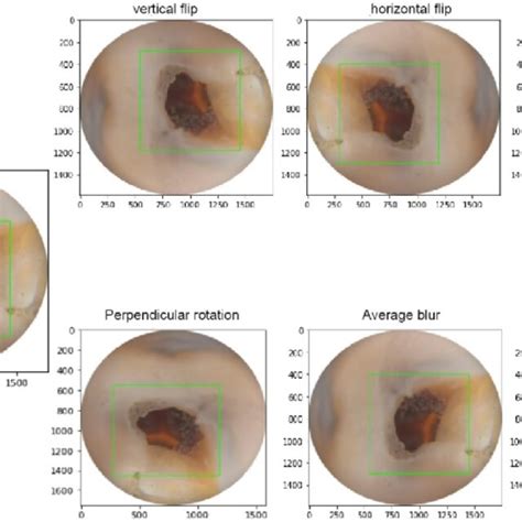 Six Types Of Data Augmentation Applied Over Each Original Image As