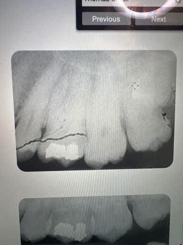 Imaging Errors Flashcards Quizlet Imaging Errors Flashcards Quizlet