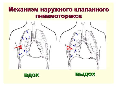 Закрытые повреждения мягких тканей презентация онлайн