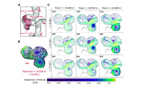 Comparisons Of Flow Streamlines And Magnitudes Of Velocity At The Download Scientific Diagram