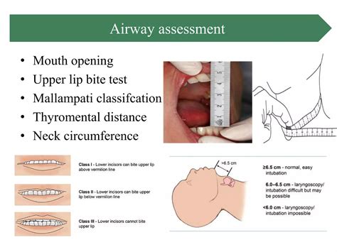 Airway Management Pptx