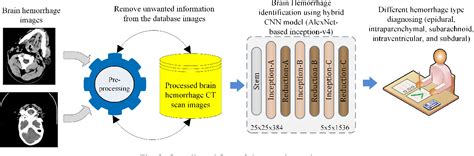 Brain Hemorrhage Detection Using Improved Alexnet With Inception V4 Semantic Scholar