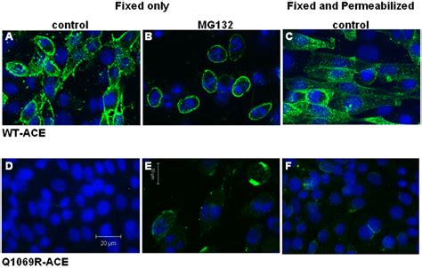 Differential Subcellular Localization Of Wild Type And Mutant Ace