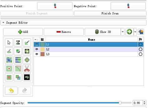 Github Paddlecv Sig Slicereisegmed D D Slicer Extension For Interactive Medical Image