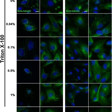 Permeabilization Before Or After PFA Fixation Affects Microtubule Download Scientific Diagram