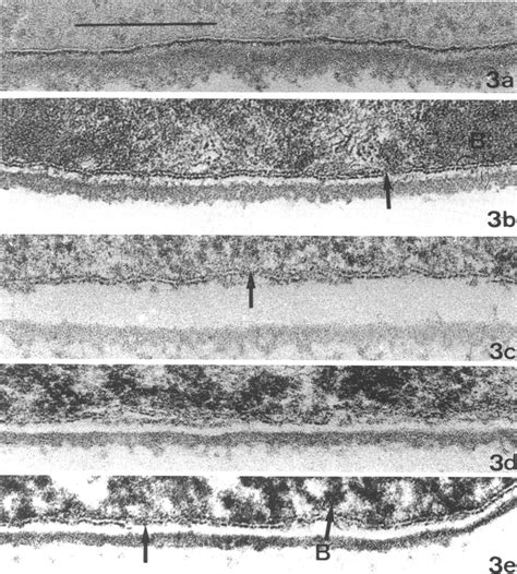 Aspects Of The Cytoplasmic Membrane Of Control And Treated B Cereus