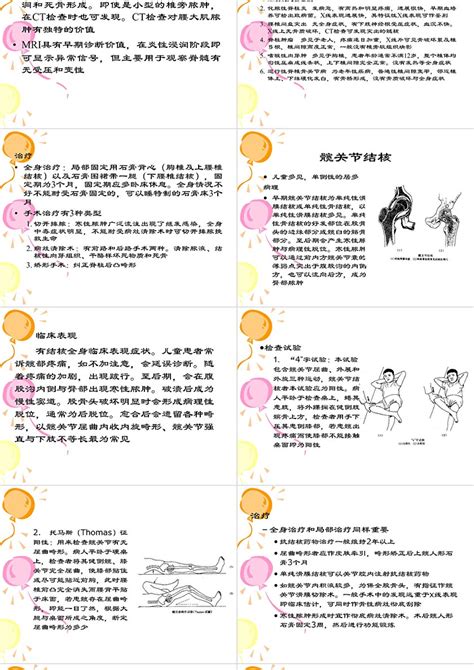 骨与关节结核PPT模板 卡卡办公