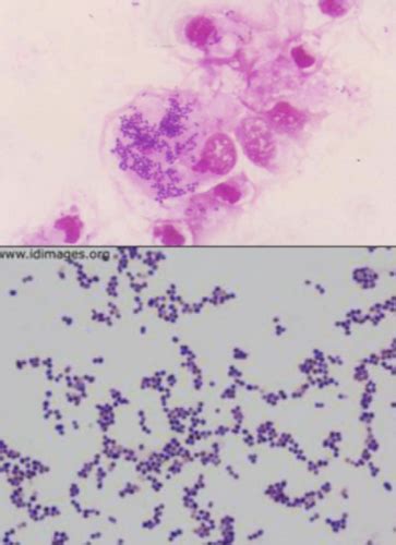 Lecture 9 Corynebacteria Spp Flashcards Quizlet