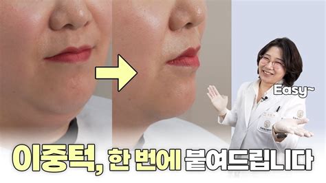 온다 리프팅 실리프팅의 놀라운 효과 이중턱 없애기 2탄 Youtube