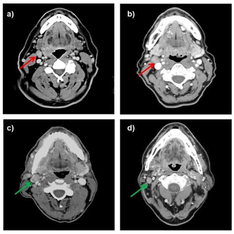 Diagnostics Special Issue Head And Neck Imaging