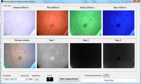 The Software Of Image Processing Download Scientific Diagram