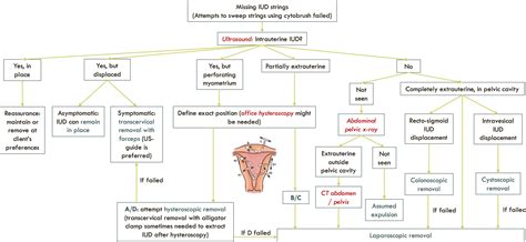 Intrauterine Device Translocation Case Series And Management Algorithm Journal Of