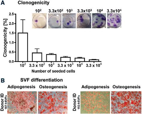 Figure 1 From Safety Of Human Adipose Stromal Vascular Fraction Cells