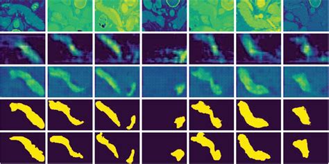 Examples Of Our Dran Segmentation Results And Feature Visualisation Of Download Scientific