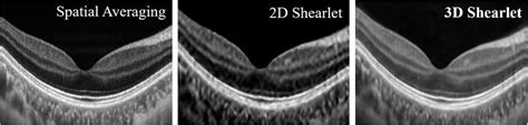 Denoising Comparison Using Spatial Averaging 2d Shearlet Filtering Download Scientific