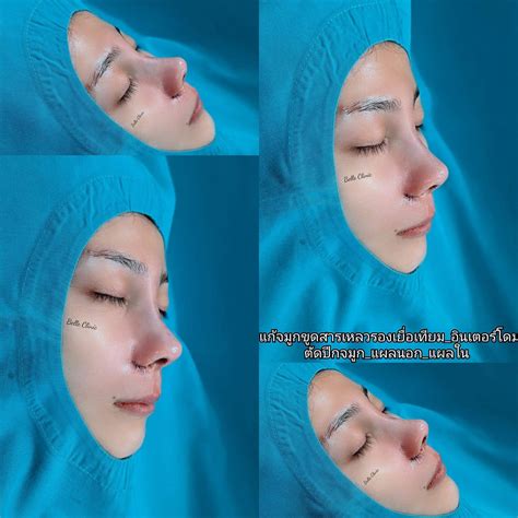 Wow สวยปังปุ Belle Clinic เบลล์คลีนิกเวชกรรม เพจหลัก