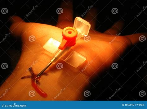 Arterial Blood Draw Stock Image Image Of Intra Medicine 1562019