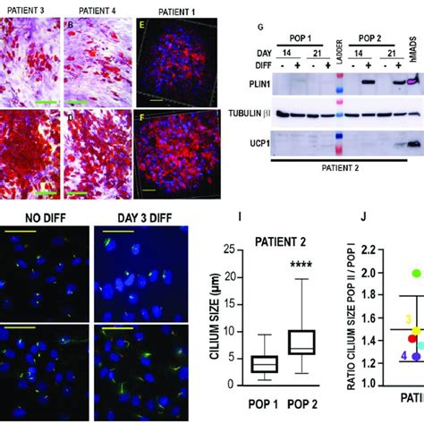 Facs Analysis Of Breast Adipose Progenitor Cell Apc Markers Expression Download Scientific