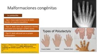 Alteraciones Del Miembro Superior Comunes Pdf