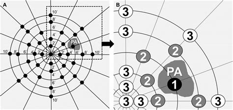 Schematic Illustration Of Microperimetry Sensitivity Map In Eye With Download Scientific