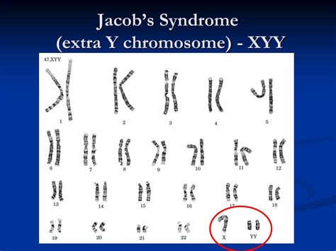 Ppt Karyotype Curiosities Powerpoint Presentation Free Download Id