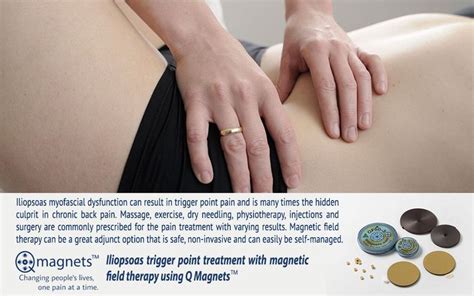 Understand The Iliopsoas Muscle And Identify The Trigger Points For