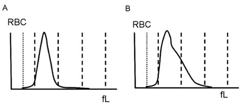 An Example Of An Red Blood Cell Rbc Histogram Before A And After Download Scientific An Example Of An Red Blood Cell Rbc Histogram Before A And After Download Scientific