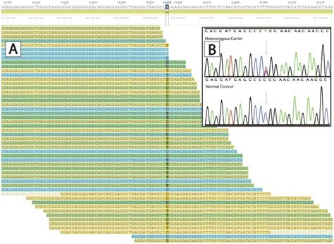 the alignment and sanger sequencing profiles of the tnnt2 r173w variant