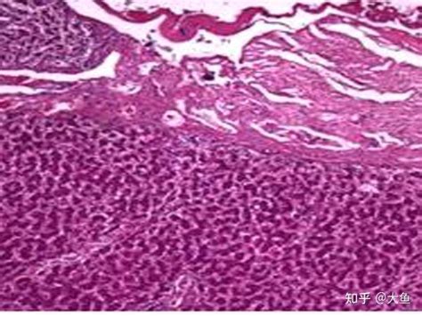 1、上皮组织与结缔组织结构的区别 知乎