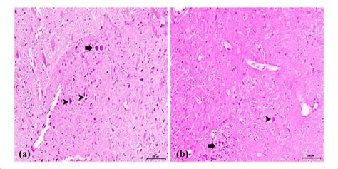 Histopathology Of Te A Toxoplasma Gondii Tissue Cysts Arrow And