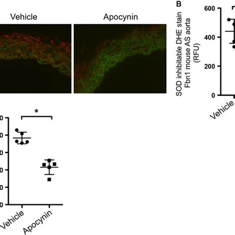 A Representative Image Of Dhe Staining Red In 8‐wk‐old Fbn1 Mouse As Download Scientific