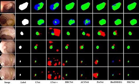 frontiers frcnet feature refining and context guided network for