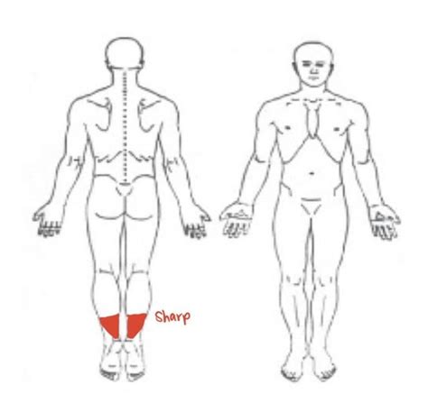 Le Dx Chart Flashcards Quizlet