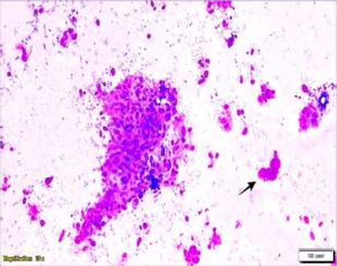 Cellular Cluster With Round To Oval Cells Occasional Cells Show Highly Download Scientific