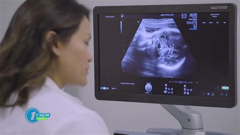 Жирэмсний ургийн гажгийг тодорхойлох шинжилгээ Youtube