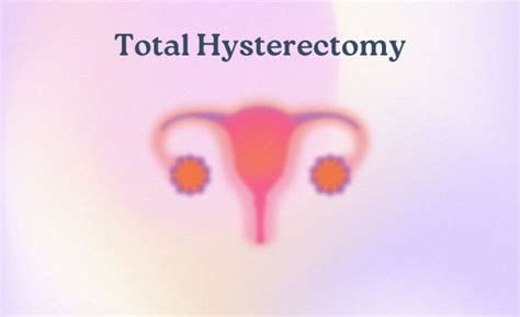 Understanding Total Hysterectomy A Patients Perspective