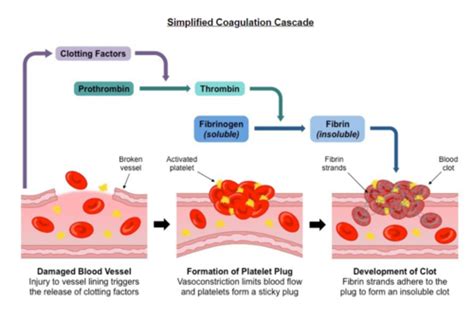 Clotting Disorders Hypercoagulable States Flashcards Quizlet