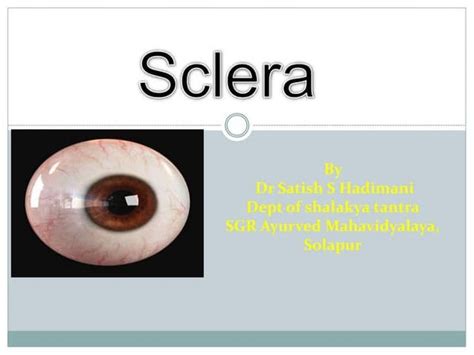 Diseases Of Sclera