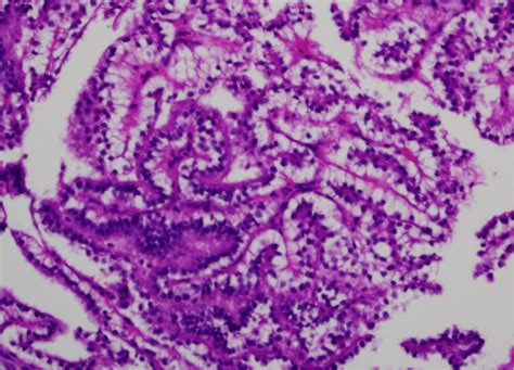 5 Questions With Answers In Teratoma Science Topic