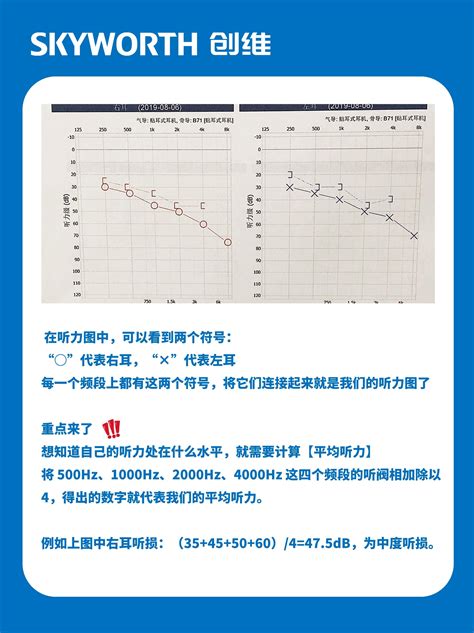 0基础也能看懂听力检测图建议收藏 知乎