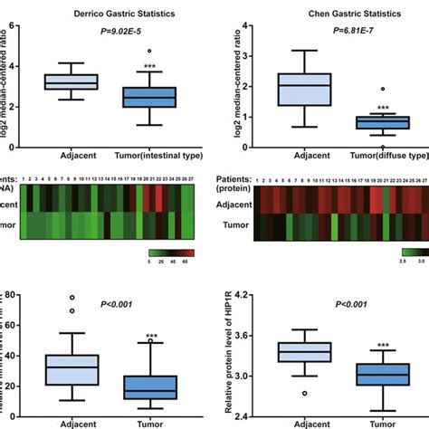 The Roc Curve Shows The Analysis Of Hip1r In The Subgroup Of Gastric Download Scientific