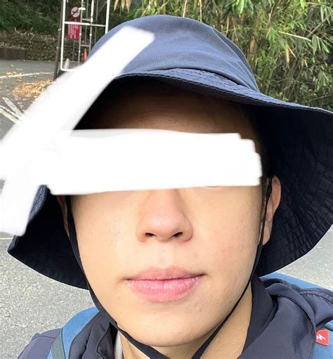請益這是蠕形蟎蟲症狀嗎？內有噁圖！ 美妝板 Dcard
